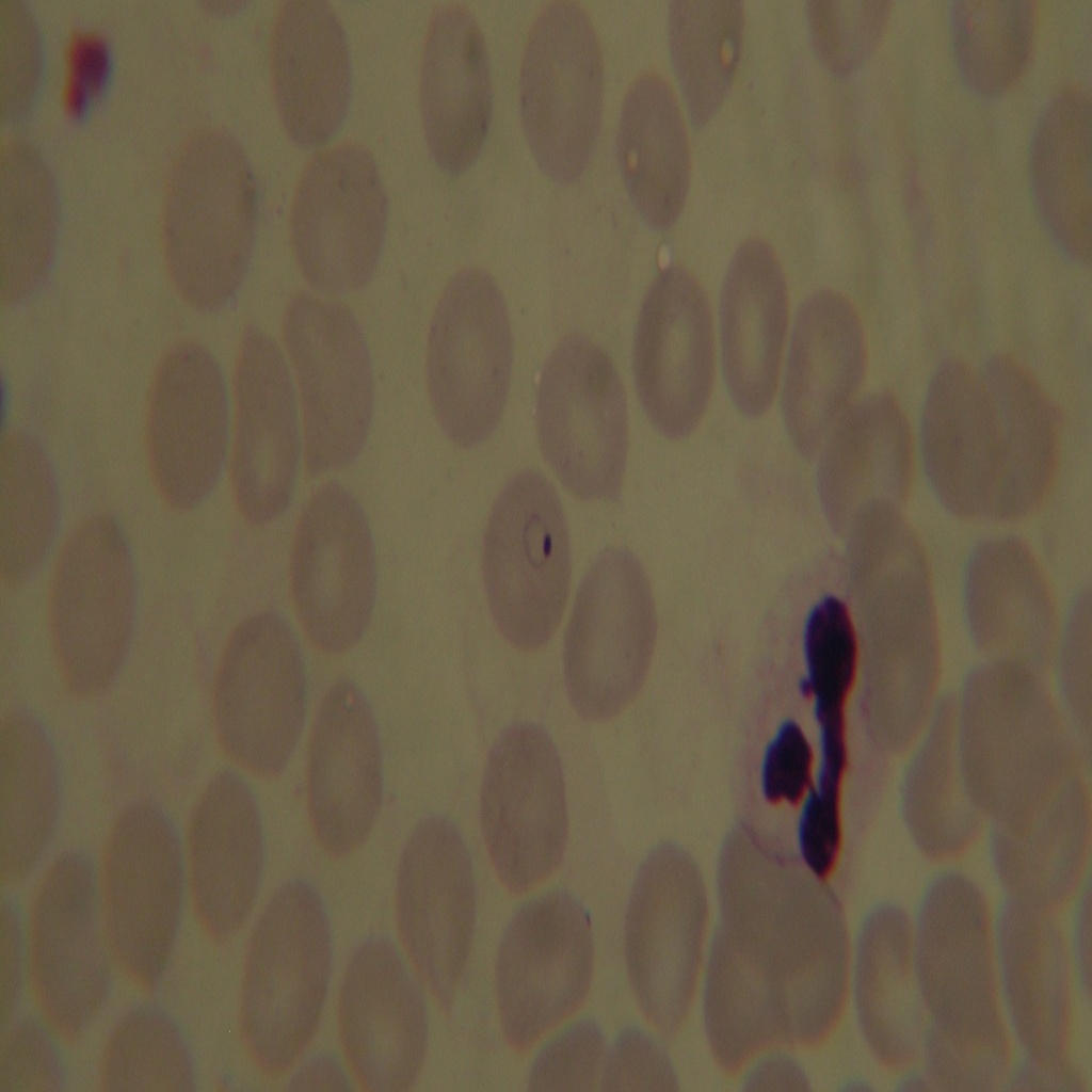 red-blood-cells Instance Segmentation Dataset (v1, 2023-07-13 2:29pm) by cells