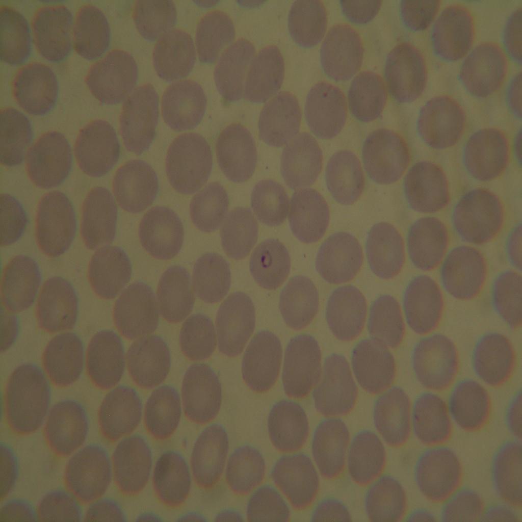 rbc3 Instance Segmentation Dataset by cells
