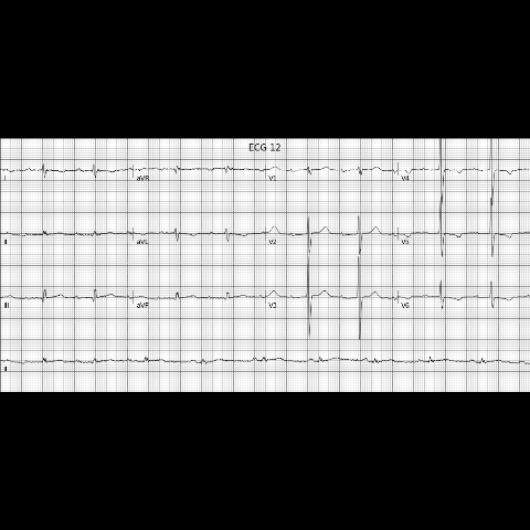 ecg Classification Dataset by Plants