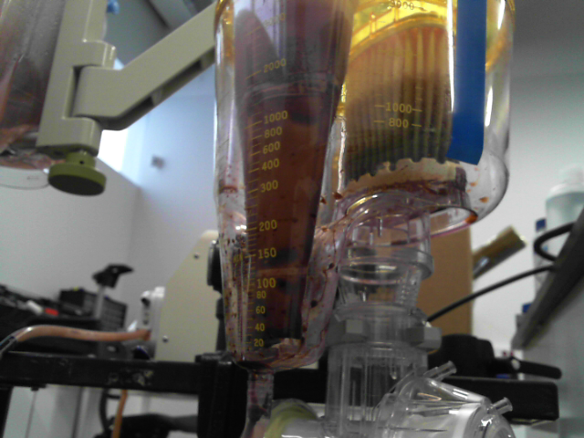 Perfusion Reservoir Object Detection Dataset By Perfusion Reservoir