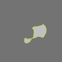 car damage segmentation Instance Segmentation Dataset and Pre-Trained Model by SInfo