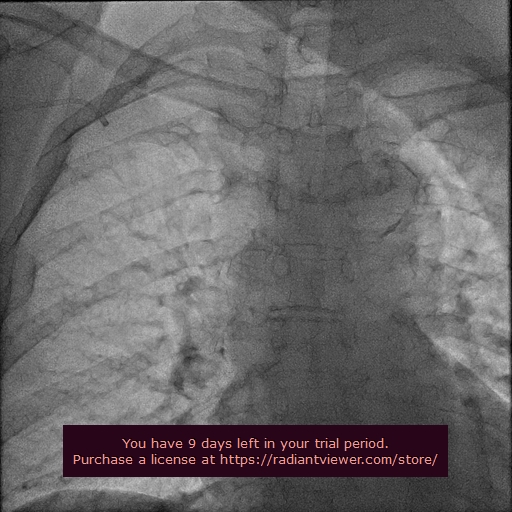 How to Use the final year project Object Detection API