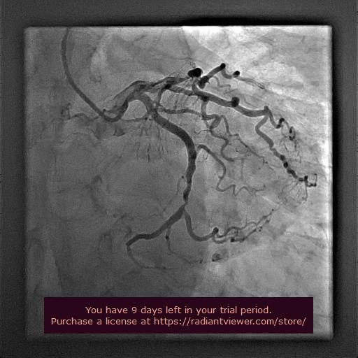 heart data Classification Dataset by heart
