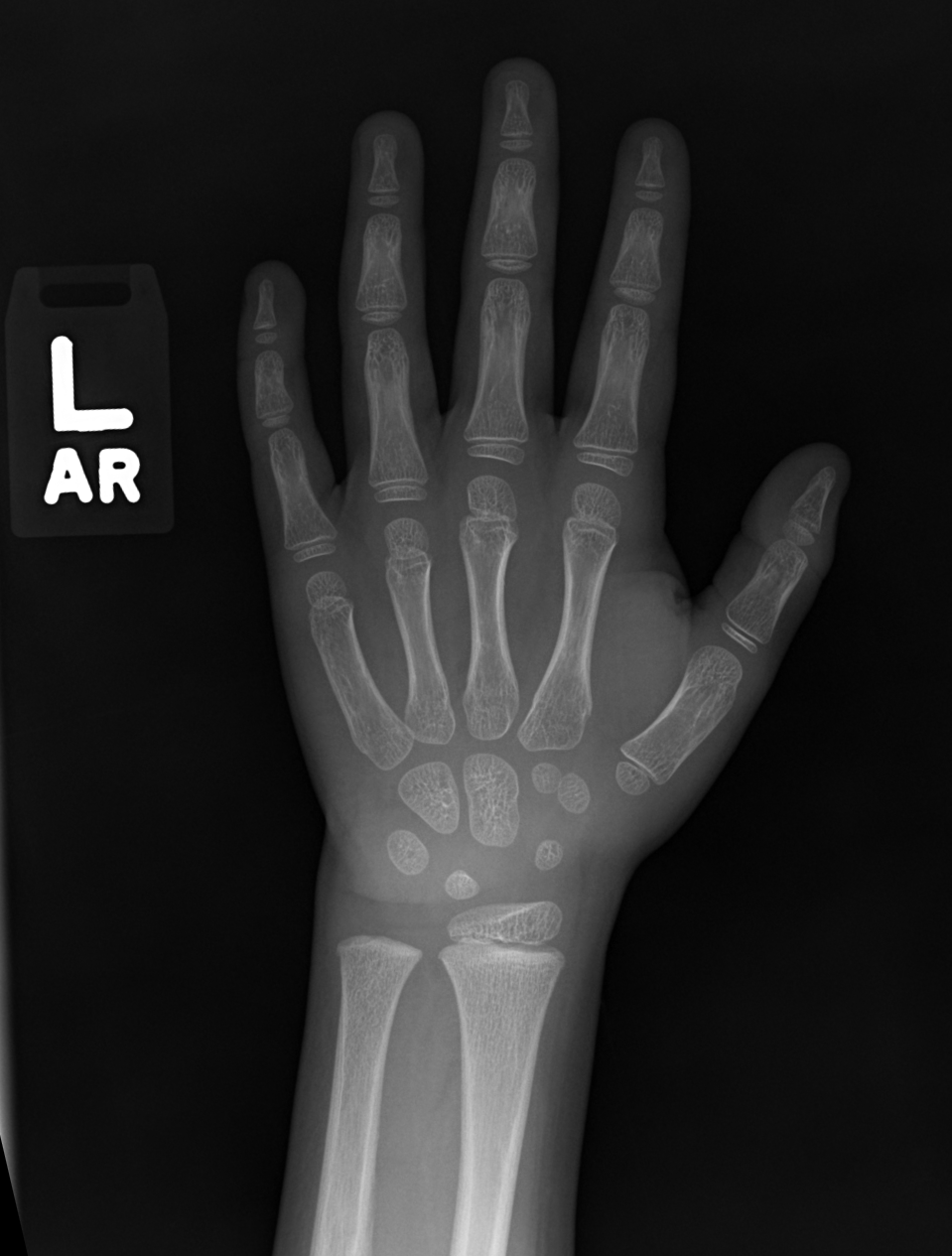bone Classification Dataset and Pre-Trained Model by bones