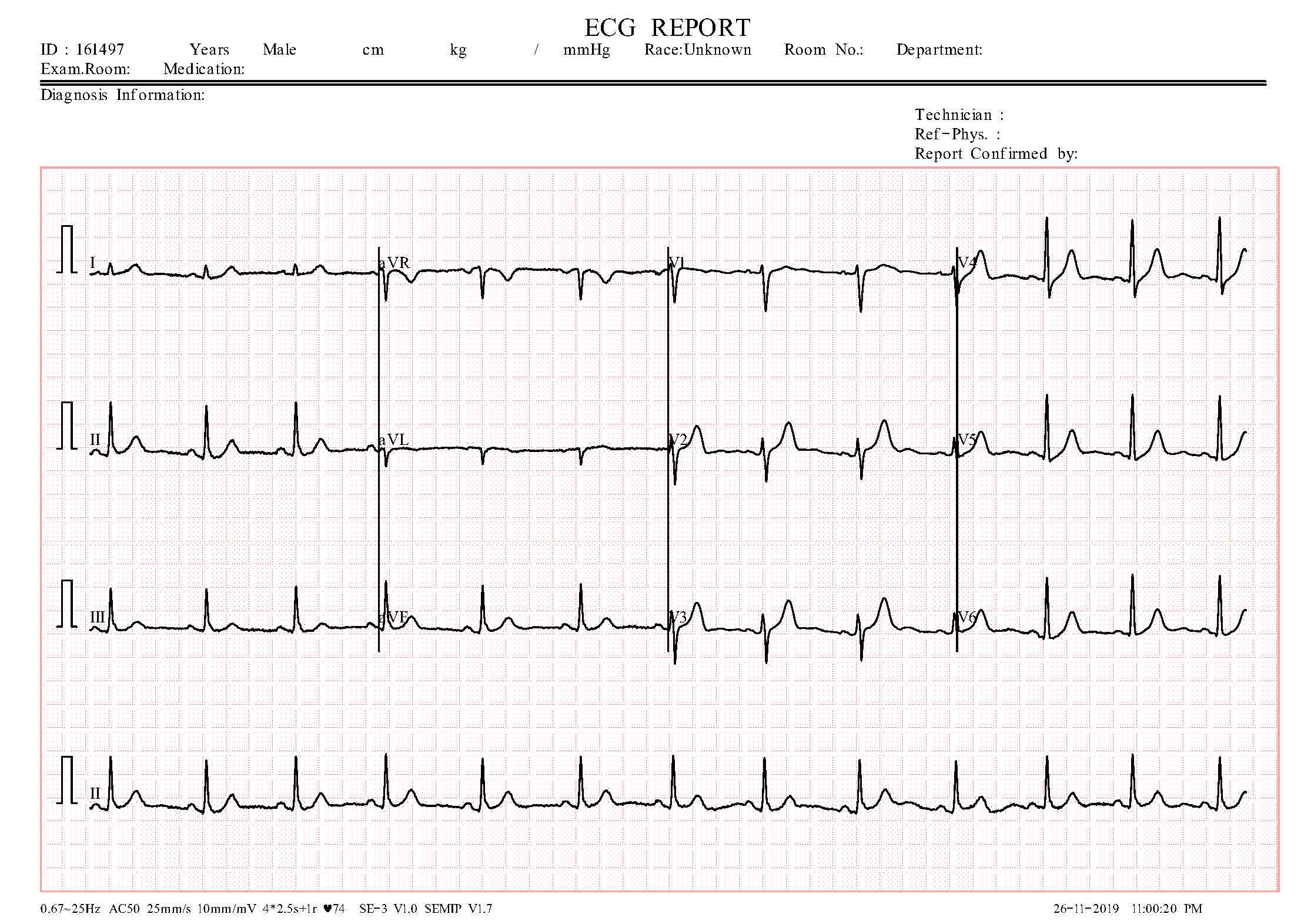 ecg Classification Dataset by computer science