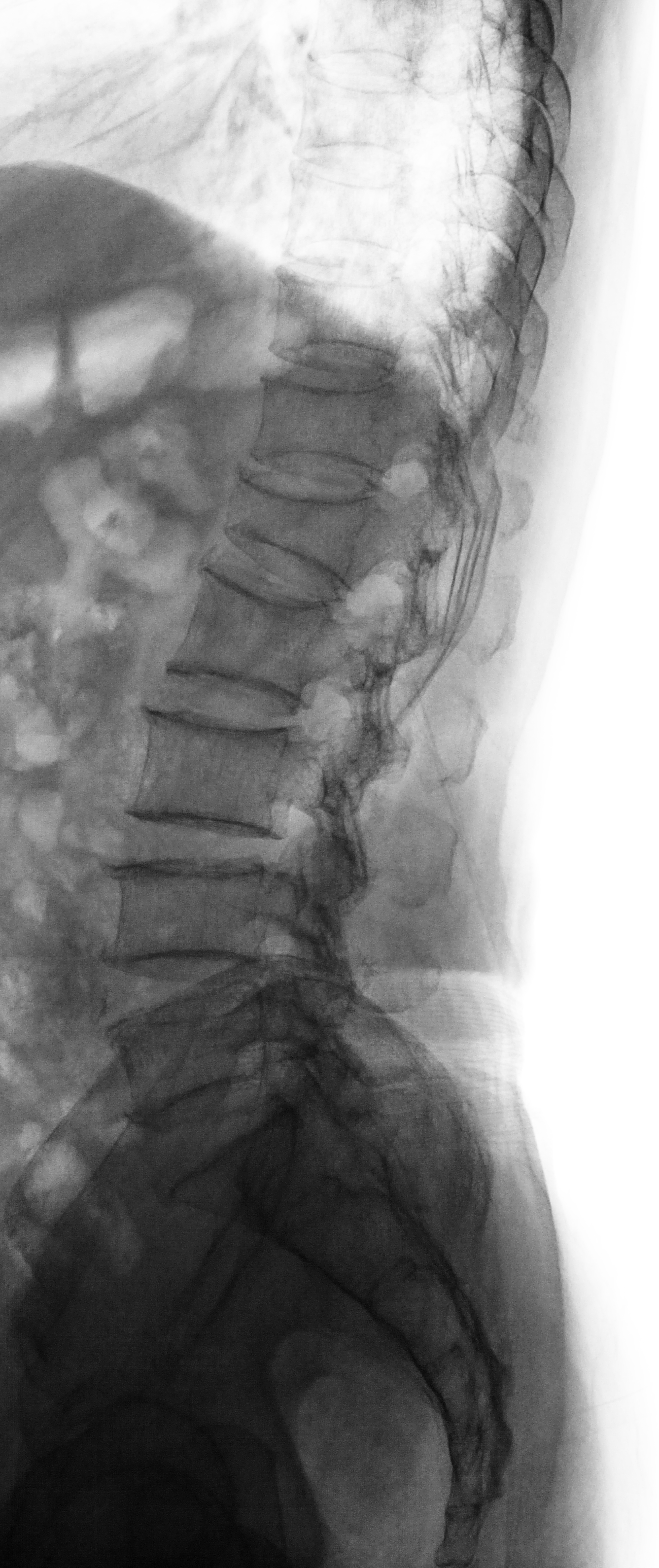nocervclassification Classification Dataset and Pre-Trained Model by ...