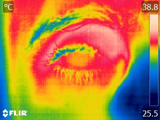 Glaucoma Classification Dataset by new-workspace-1dxty