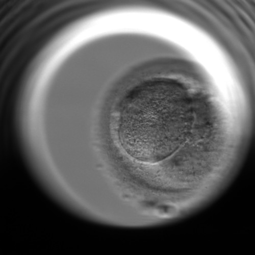Oocyte_embryo quality prediction Object Detection Dataset by 360 digitmg