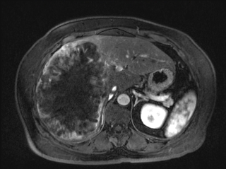 Lesion detection MRI+CT Object Detection Dataset by RVB
