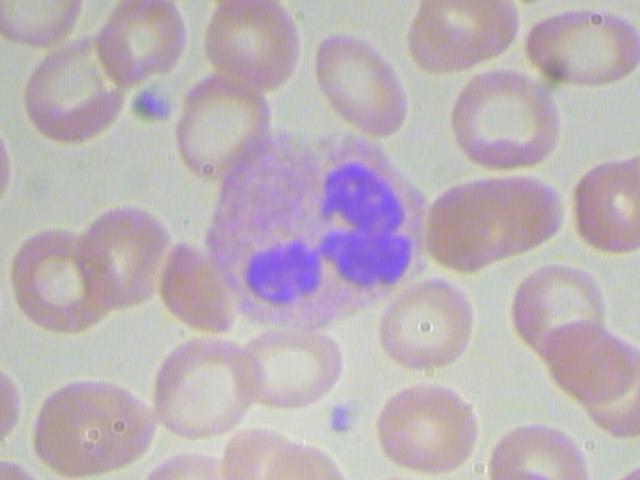 blood detection Object Detection Dataset by SQU