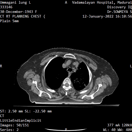lung cancer Instance Segmentation Dataset and Pre-Trained Model by ...
