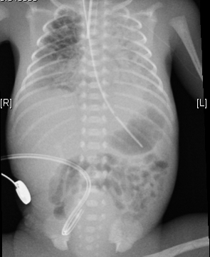 Medical Desease Object Detection Dataset by Medical Desease Analyzer