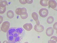 BCCD Object Detection Dataset by Roboflow