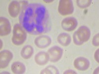 BCCD Object Detection Dataset by Roboflow