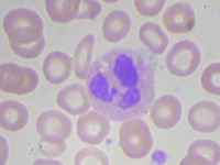 BCCD Object Detection Dataset by Roboflow