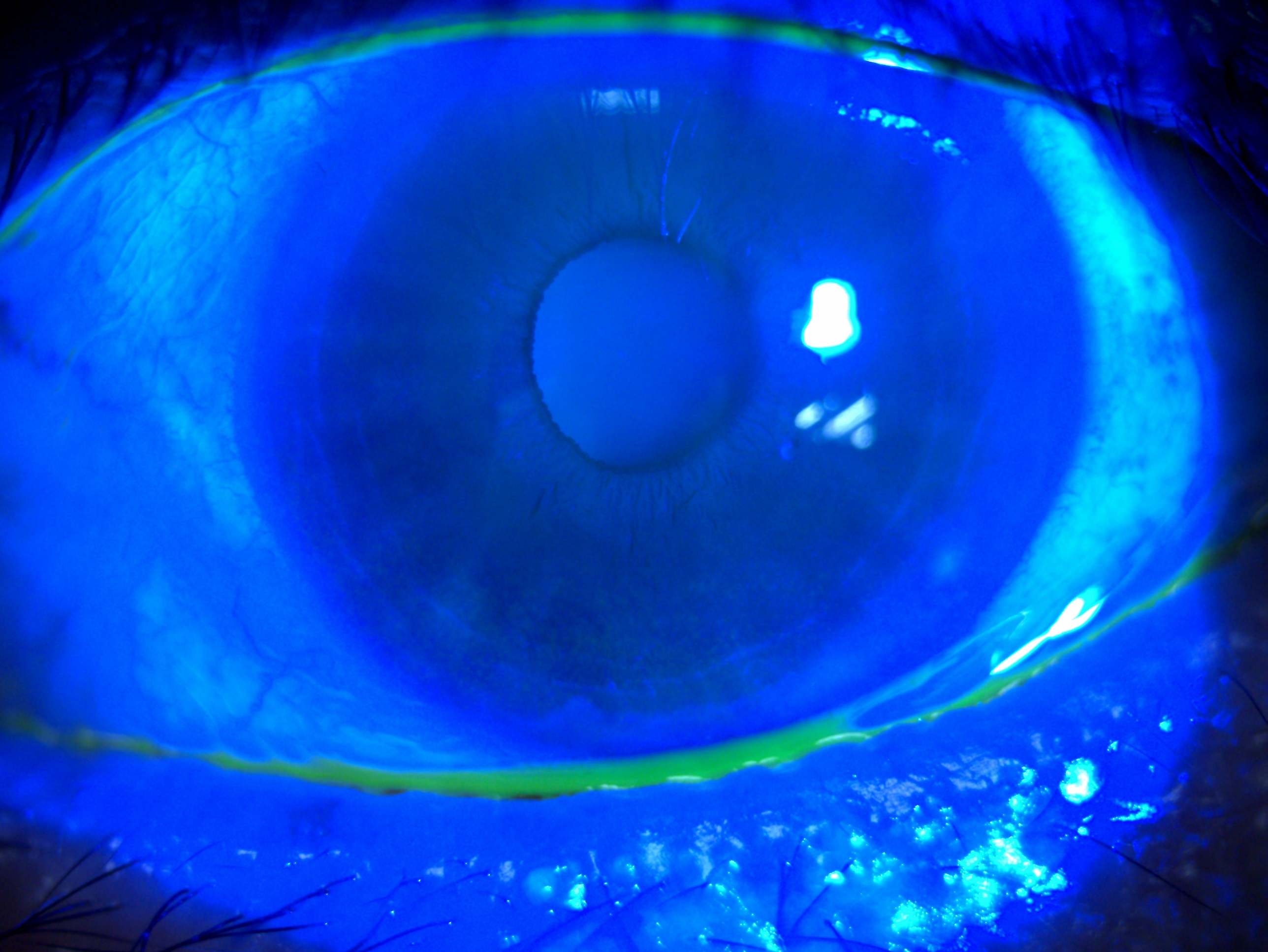 eyes_light Object Detection Dataset by new-workspace-rjarb