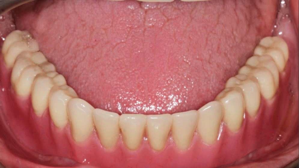 Dental Dataset Level1 Object Detection Dataset And Pre Trained Model By