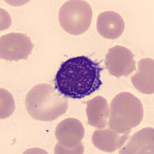 white Blood cell Object Detection Dataset and Pre-Trained Model by Telkom