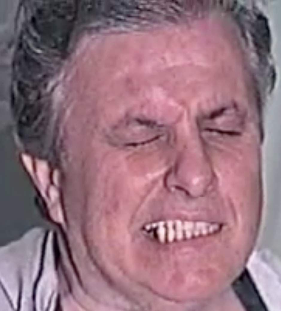 How to Use the STROKE DETECTION Object Detection API