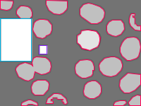 blood cell types detection Object Detection Dataset by obmslab