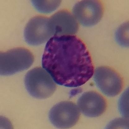 blood cell types detection Computer Vision Dataset by obmslab