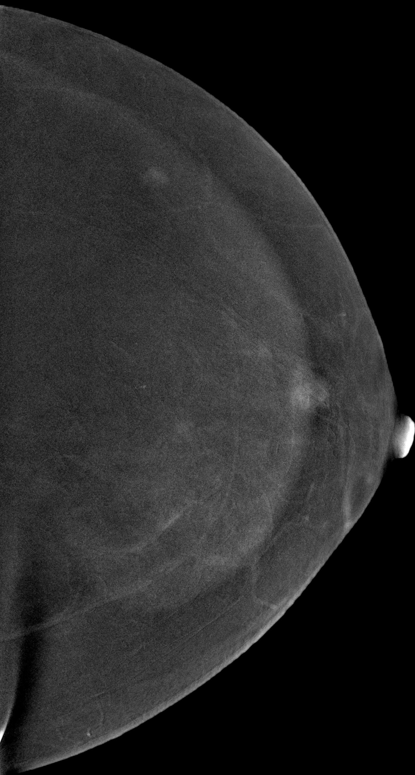 Yldz Teknik Niversitesi Yldz Teknik Niversitesi Fmmb9 Roboflow Universe