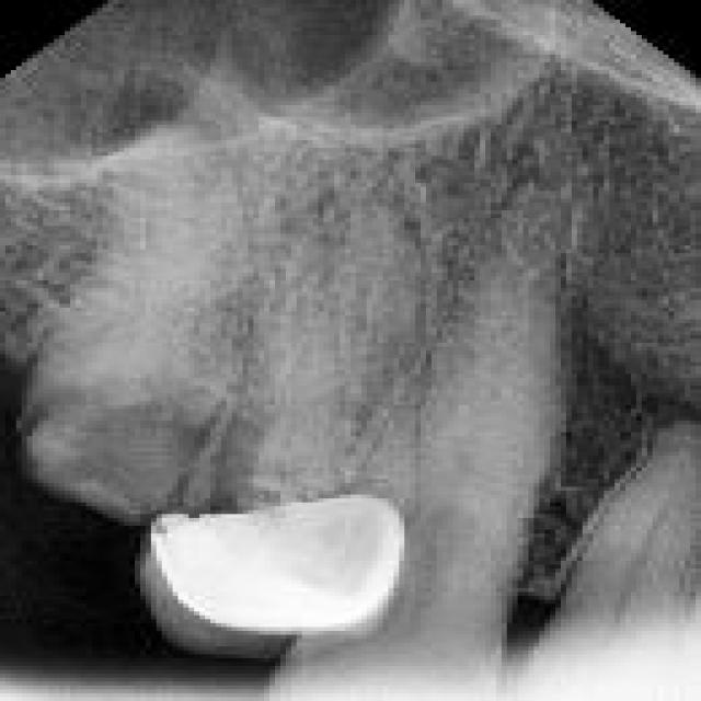 Arshs Workspace Radio Roboflow Universe