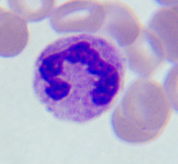 How to Use the 5 PART DIFF Instance Segmentation API