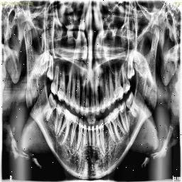 Teeth identification Object Detection Dataset and Pre-Trained Model by TEETH SEGMENTATION