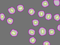 leaf_stomata Instance Segmentation Dataset by Jiaxin