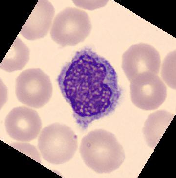 WBC pro Object Detection Dataset by satree siriket school