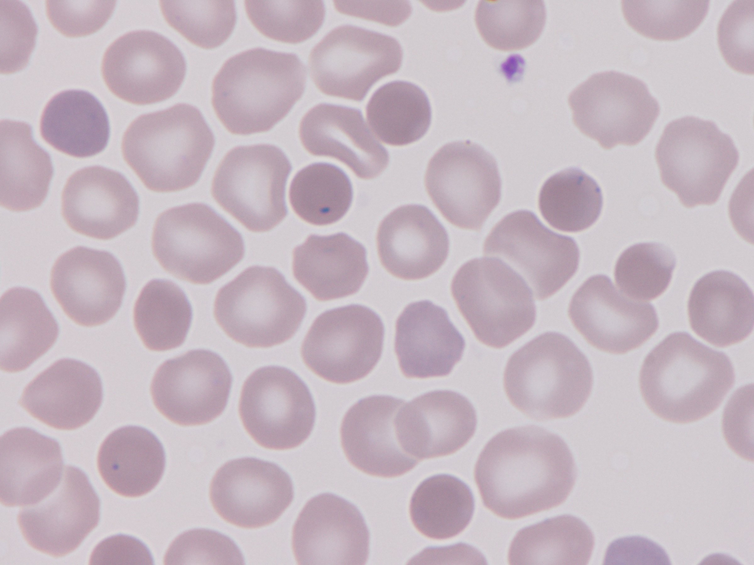 Blood Detection duplicate Object Detection Dataset by MAYUKH BANERJEE