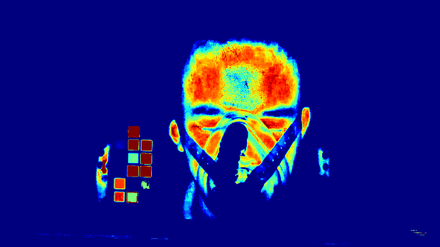 Forehead Heatmap Object Detection Dataset By Project 0fmyo