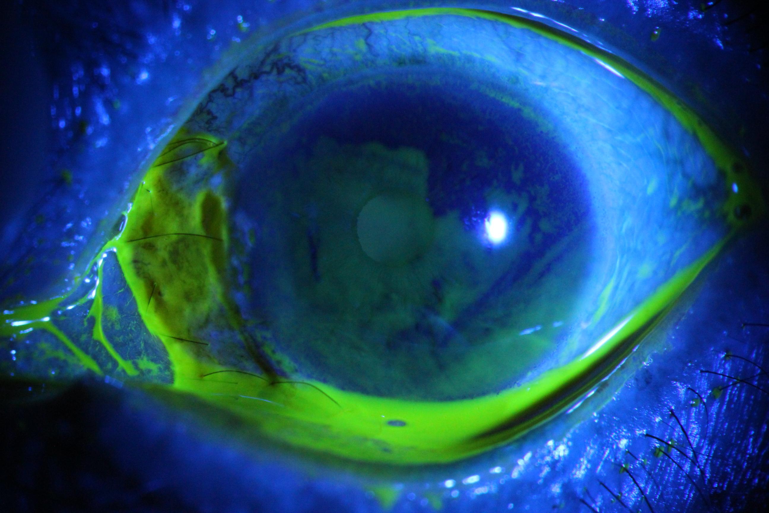 Corneal Classification Dataset and Pre-Trained Model by Test