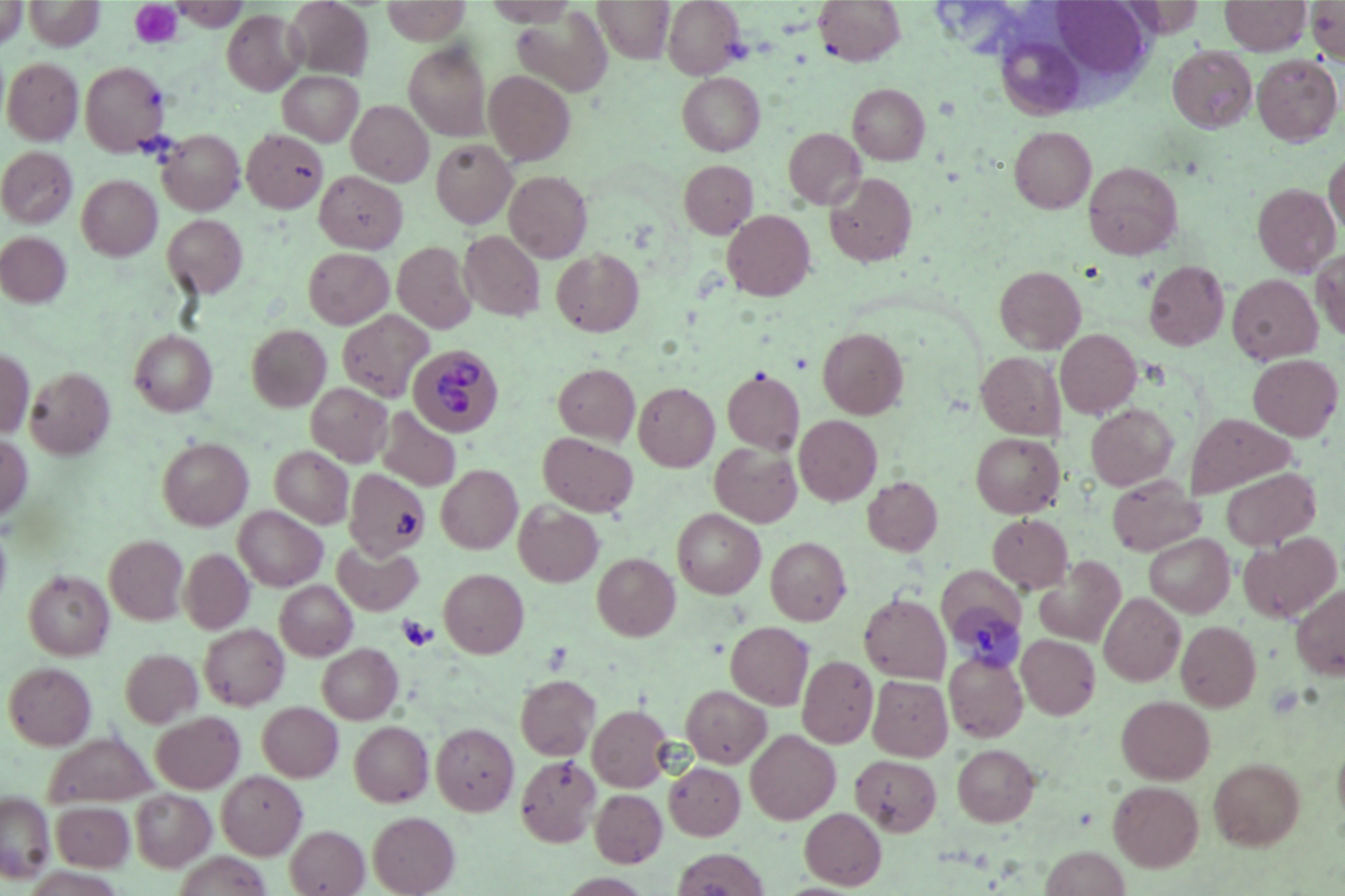 azl Instance Segmentation Dataset by My IA Projects