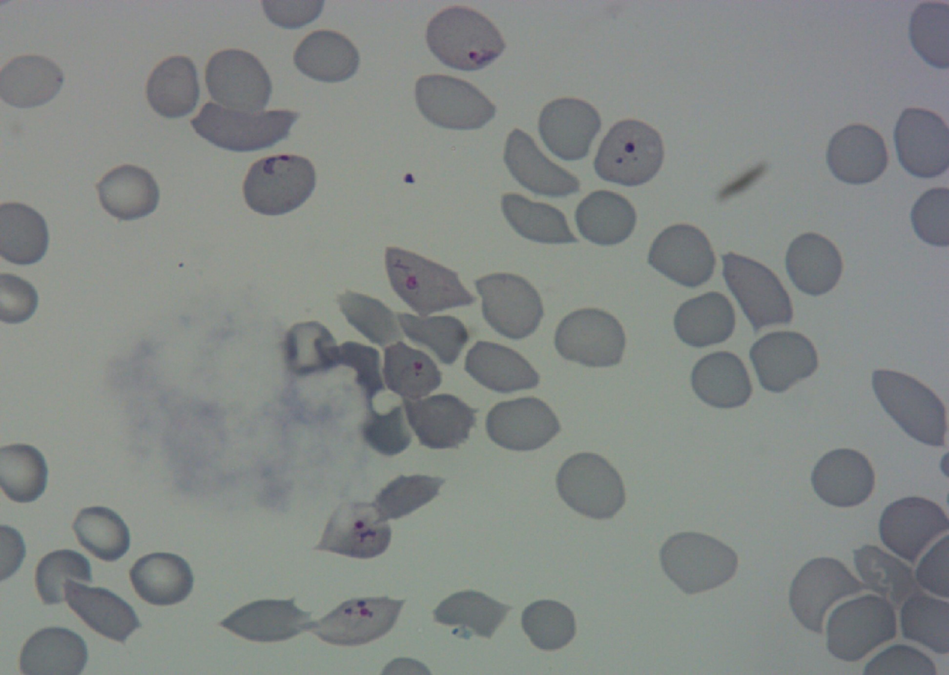 Malaria Cell Detection Object Detection Dataset V1 2023 09 28 11 25pm By Image Detection