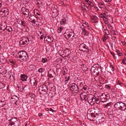 Mitosis-Detection-YOLO Instance Segmentation Dataset by Rafi kk Mitosis-Detection-YOLO Instance Segmentation Dataset by Rafi kk