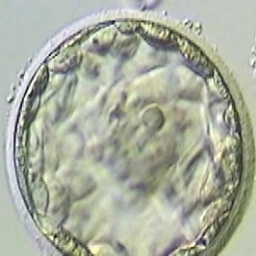 Embryo Classification Object Detection Dataset by Embryo