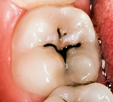 mydata Object Detection Dataset and Pre-Trained Model by Faster RCNN