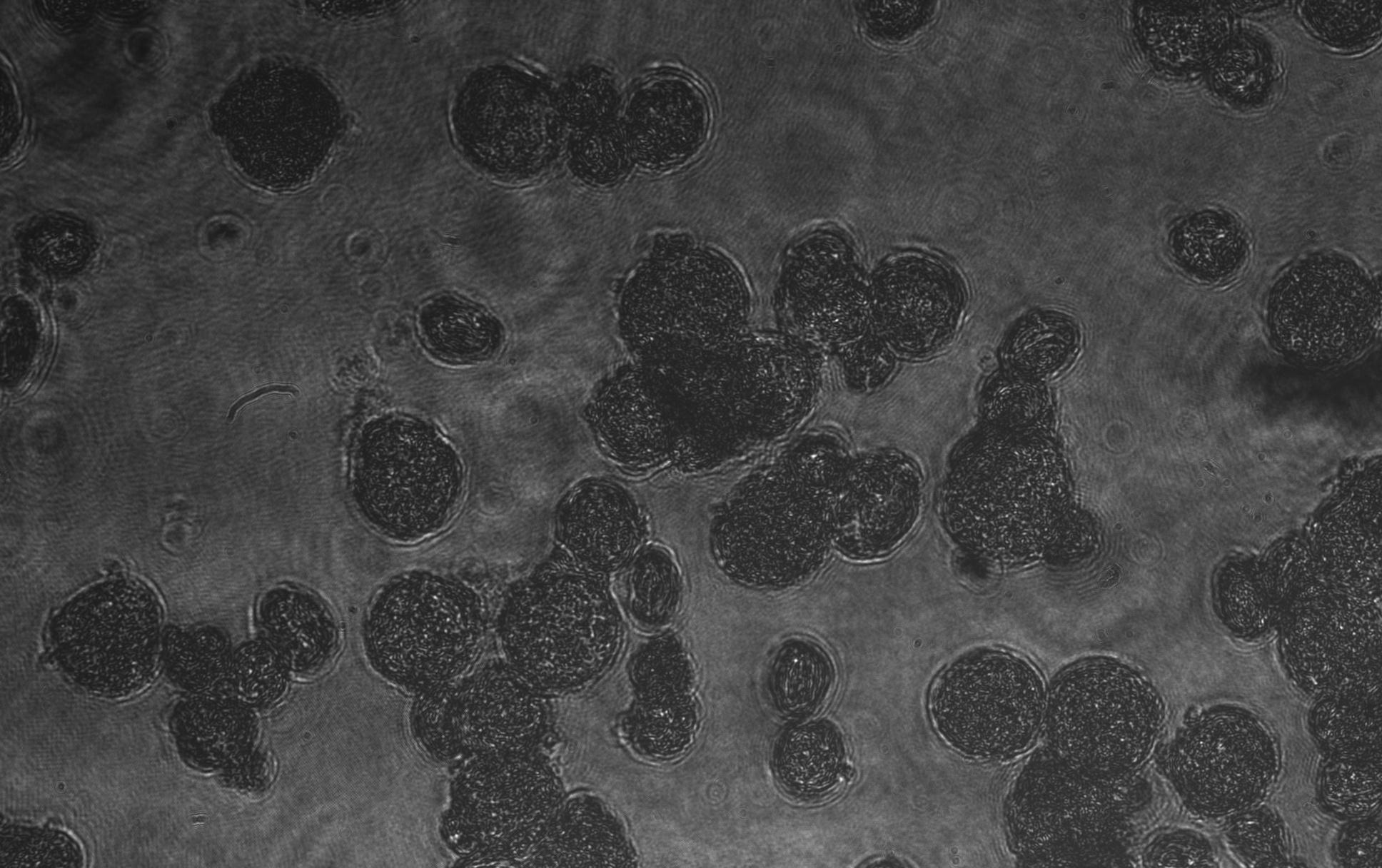 Pollen6 Object Detection Dataset By Pollen Classification