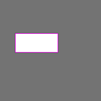fracture segmentation Semantic Segmentation Dataset by graduation project