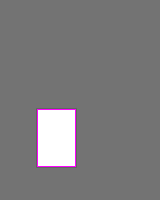 fracture segmentation Semantic Segmentation Dataset by graduation project