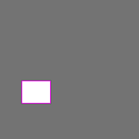fracture segmentation Semantic Segmentation Dataset by graduation project