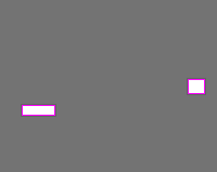 fracture segmentation Semantic Segmentation Dataset by graduation project