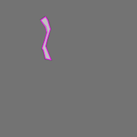 concrete surface crack detection using yolov5 model Object Detection Dataset and Pre-Trained ...