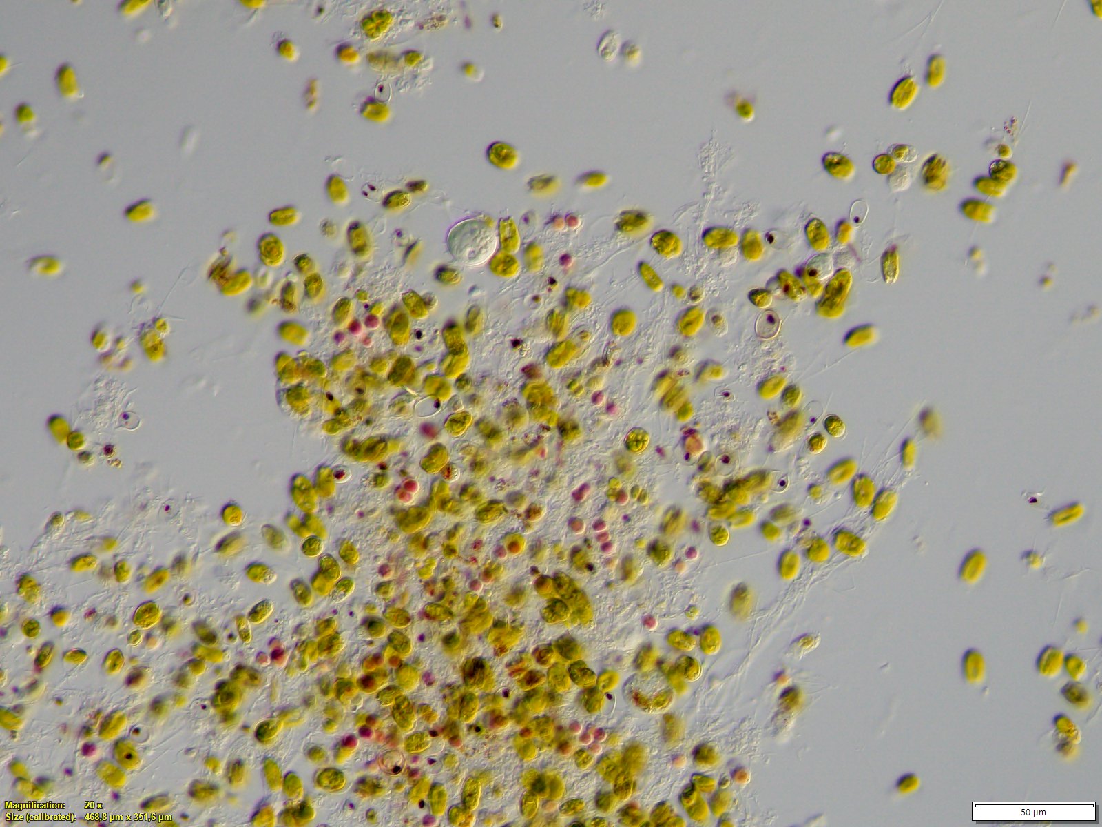 Algae Original Object Detection Dataset By Algae