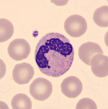 White-blood-type Object Detection Dataset and Pre-Trained Model by PSU