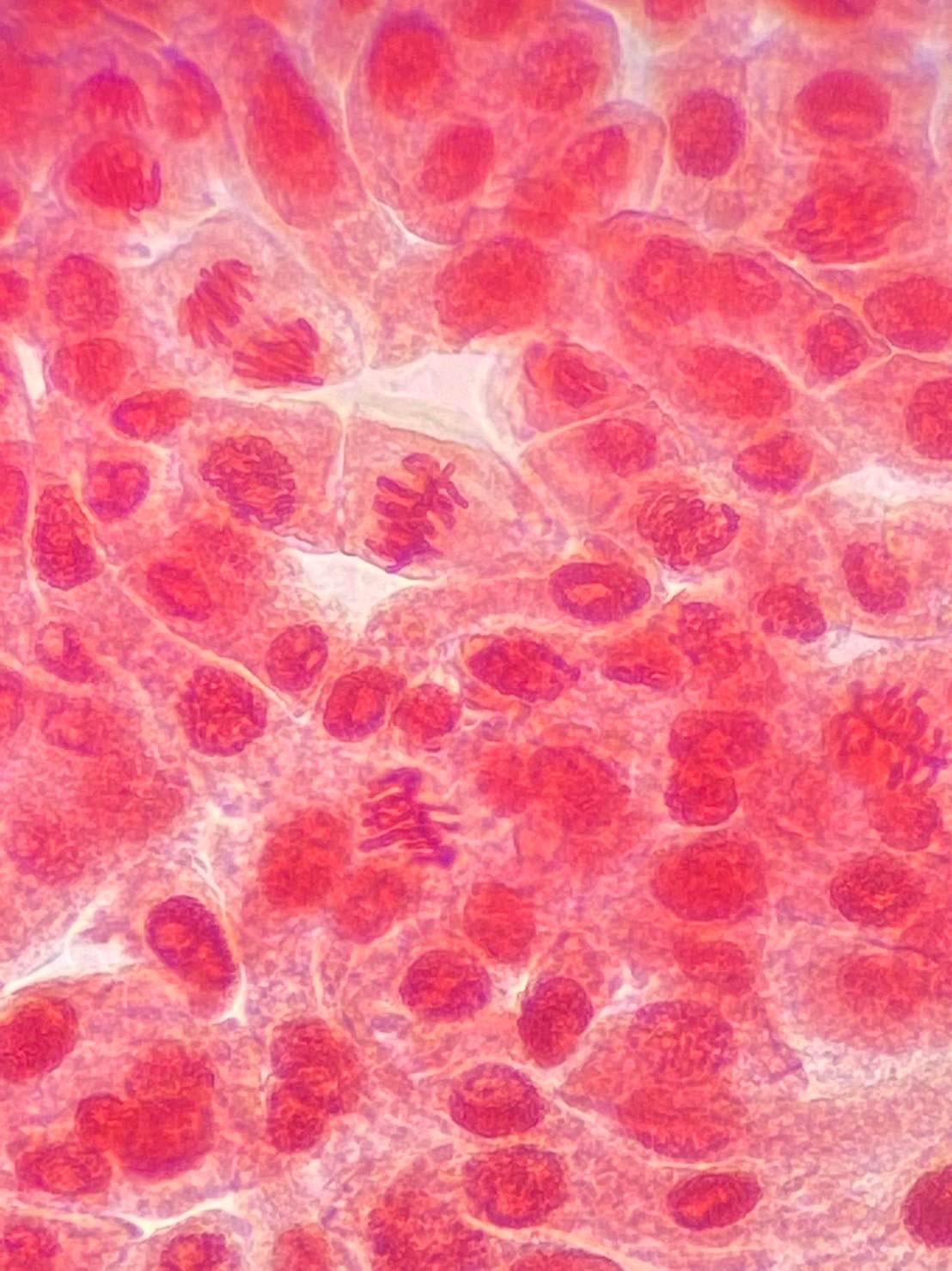 Mitosis Computer Vision Dataset by pccm Mitosis Computer Vision Dataset by pccm