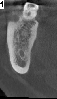 crosssect Instance Segmentation Dataset and Pre-Trained Model by crosssection