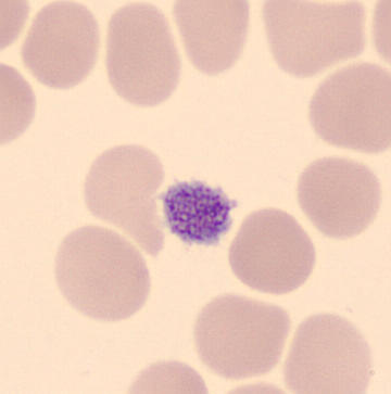 Immune Response Detection Classification Dataset and Pre-Trained Model ...